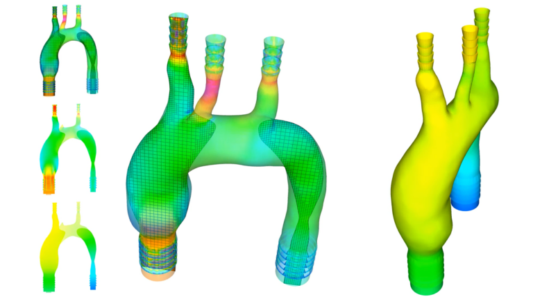 Biomedical - CONVERGE CFD Software